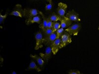 MOC1 Mouse Oral Squamous Cell Carcinoma (OSCC) Cell Line | SCC469